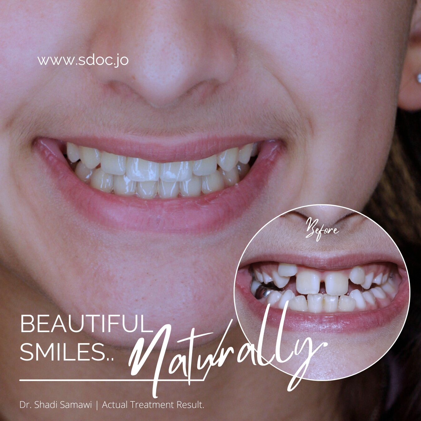 Samawi Dental & Orthodontic Center :: SDOC :: Salma